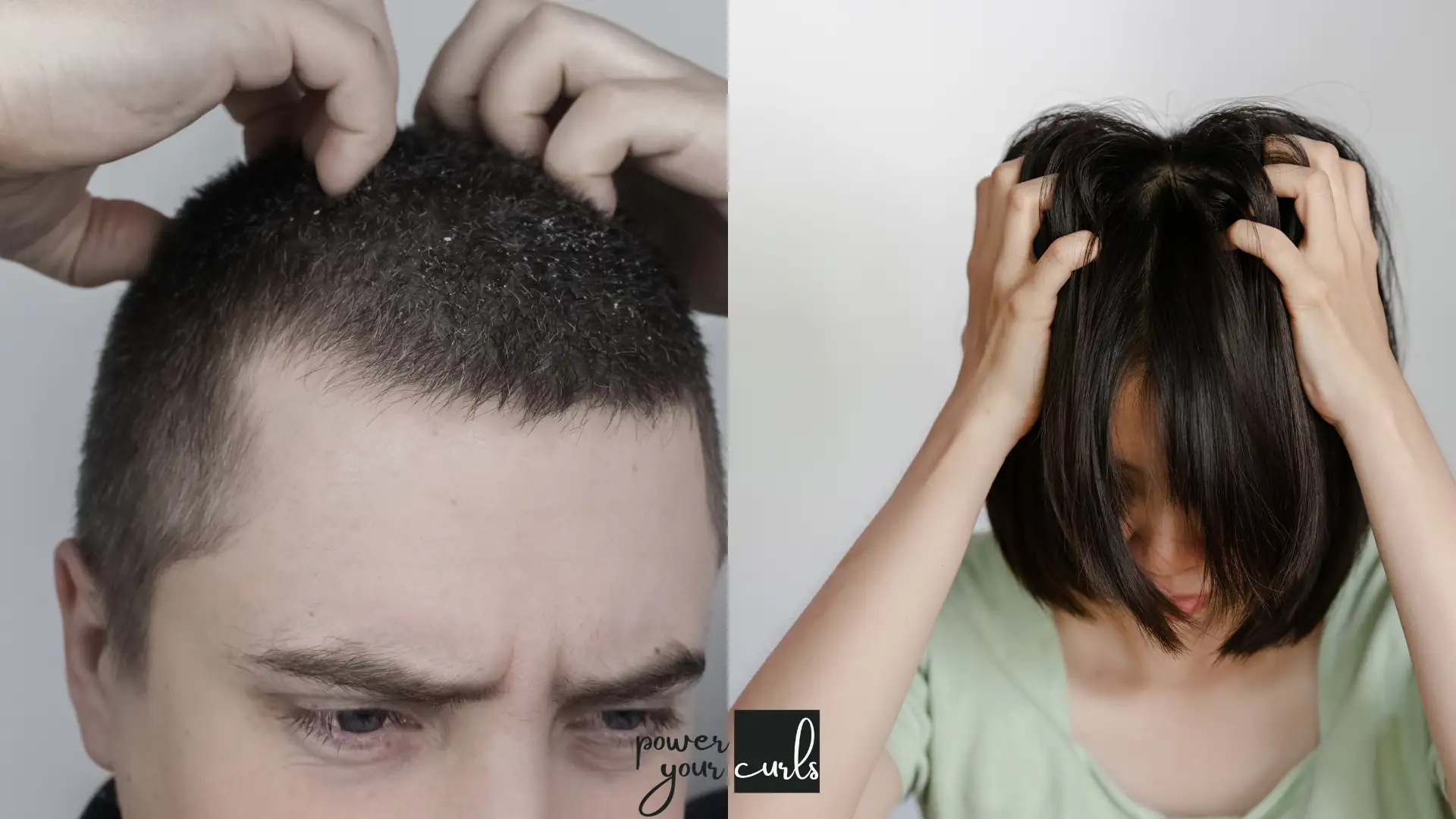 Why Is My Scalp So Itchy The Complete List Of Reasons And Proven